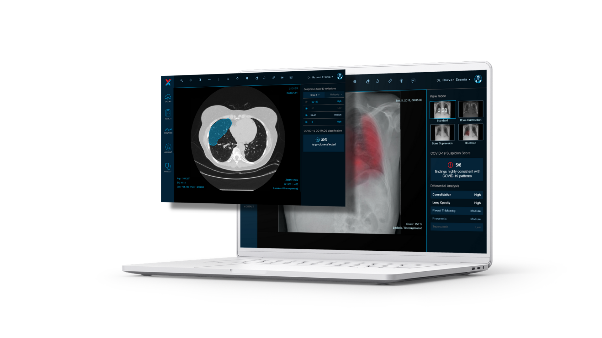 XVision receives €1 million in a new round of funding - Gap Minder